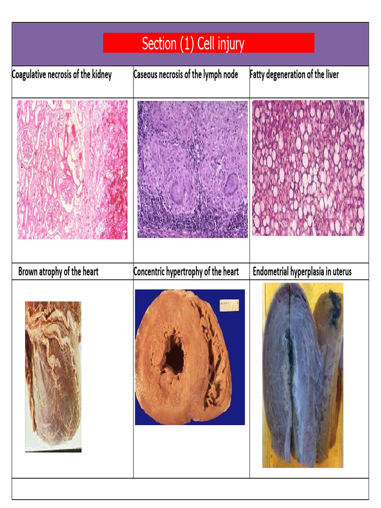 Pathology Practical Final 2023 | PDF