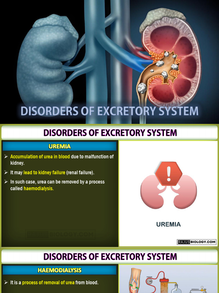 Disorders of Excretory System - Human Excretory System | PDF