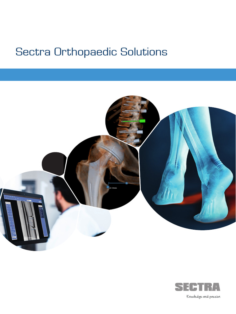 Sectra-Ortho Brochure 11.1 | PDF | Surgery | Ct Scan