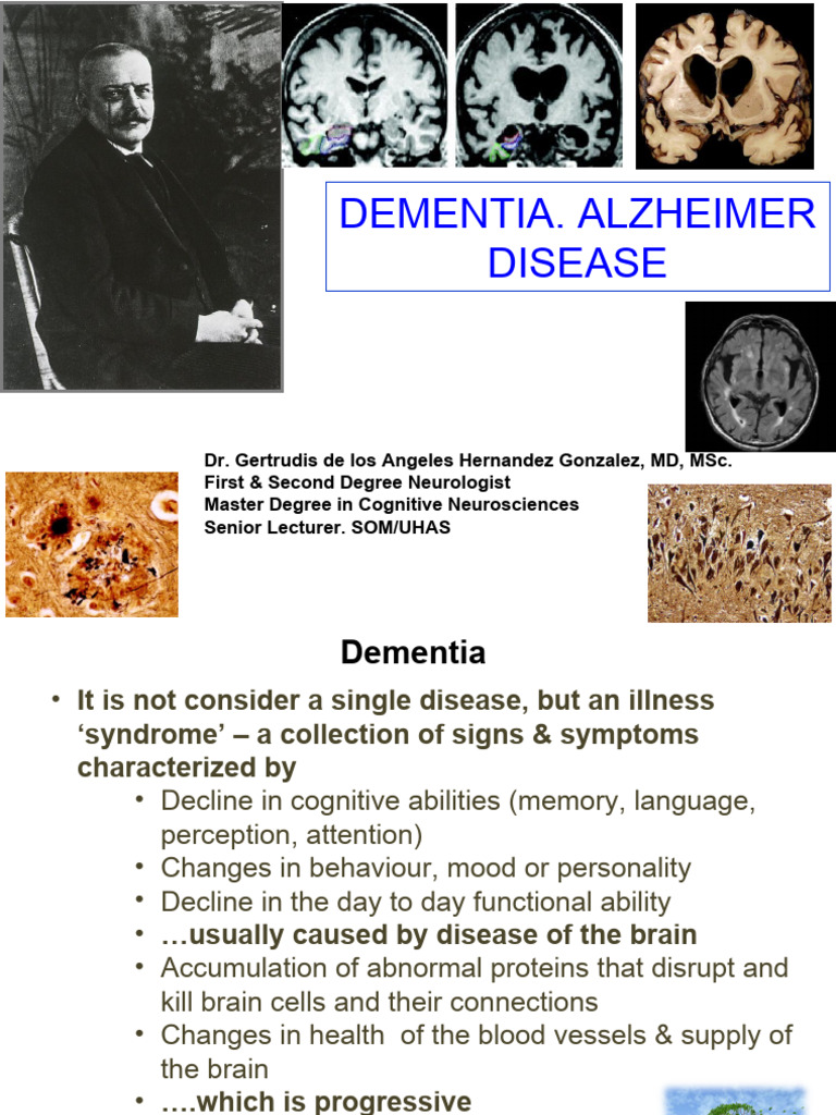 Dementia SAHS GERT | PDF | Self-Improvement | Science & Mathematics