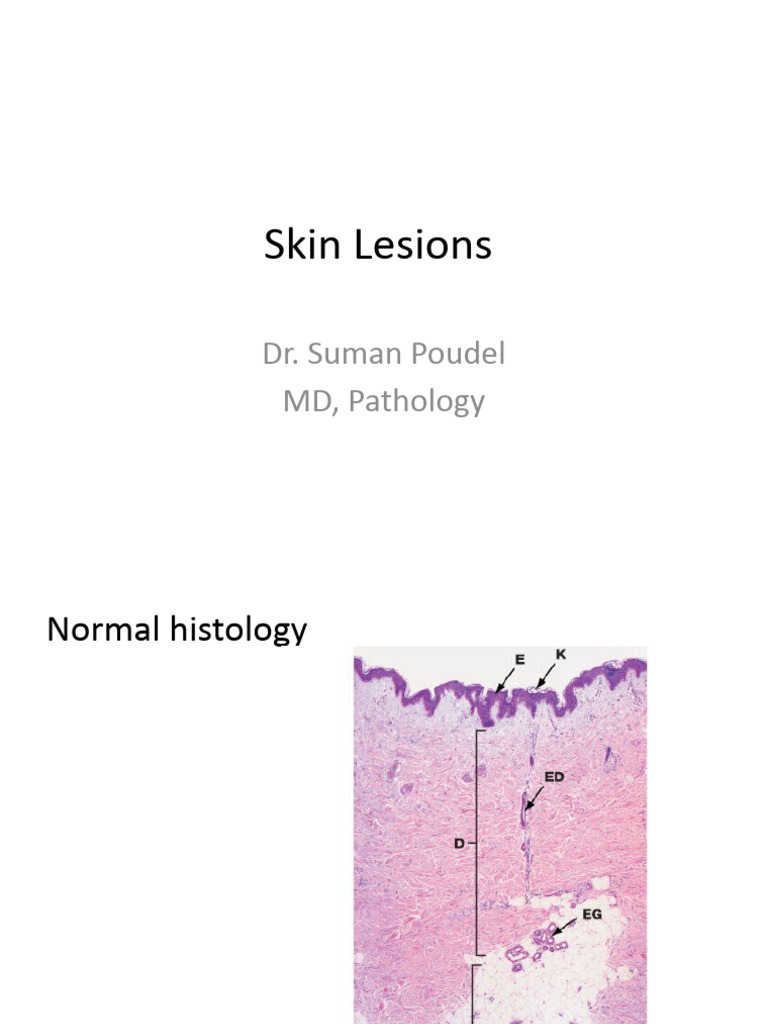 Skin Lesions | PDF