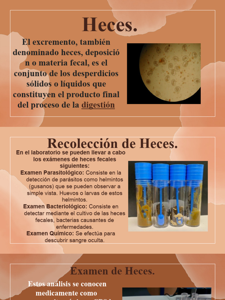 Heces. Microbiología PPT by M. BC | PDF | Heces | Medicina