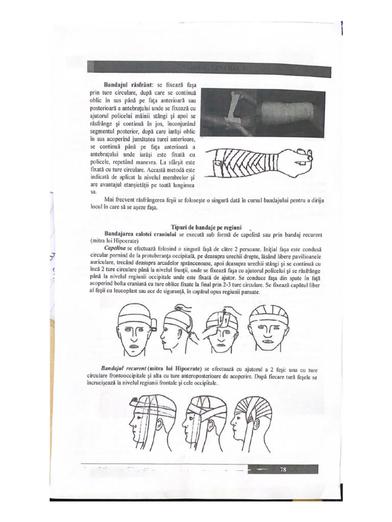 Bandajul Rãsfrânt Se Fixeazã Fasa | PDF