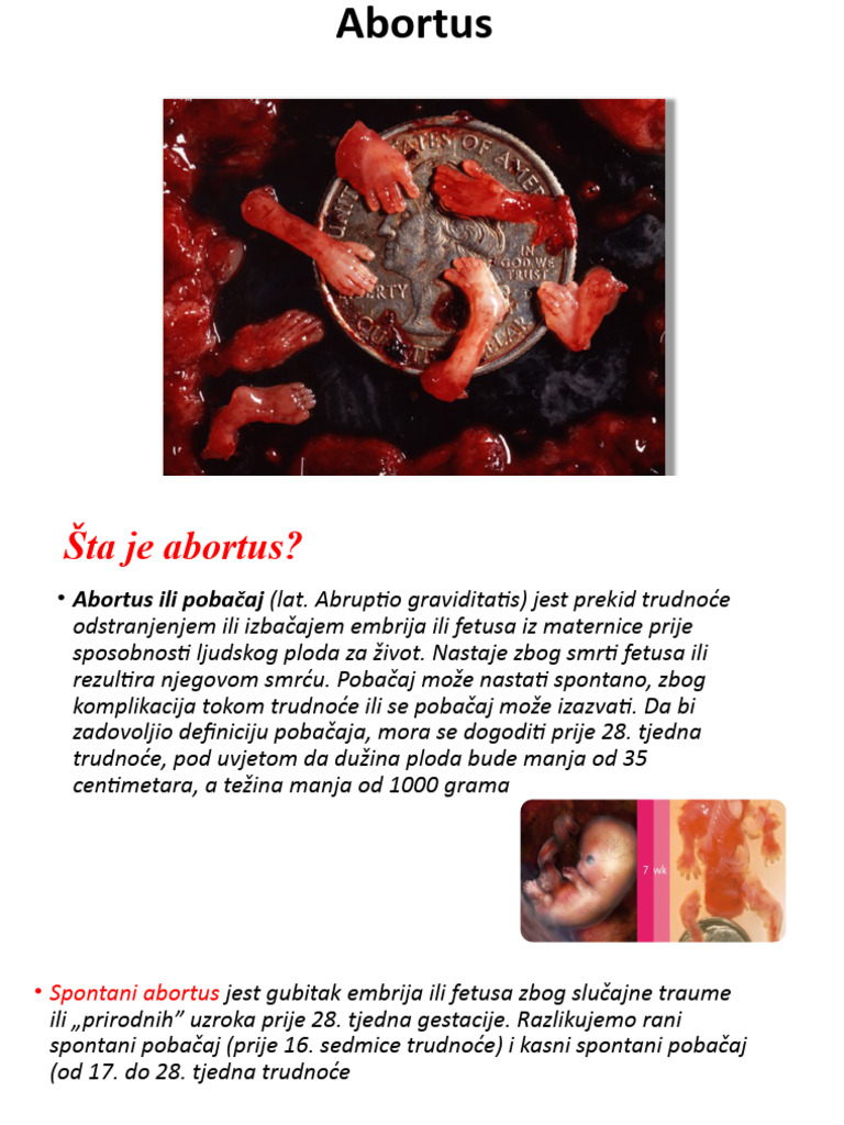 Abortus | PDF