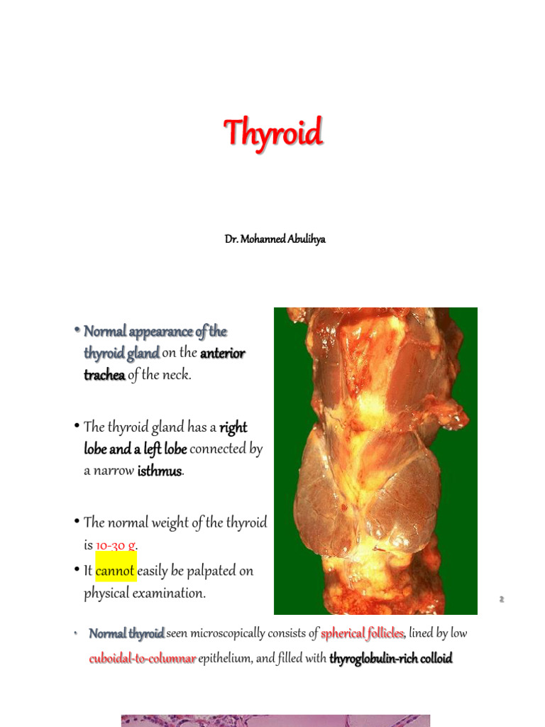 Thyroid Gland | PDF | Thyroid | Hyperthyroidism