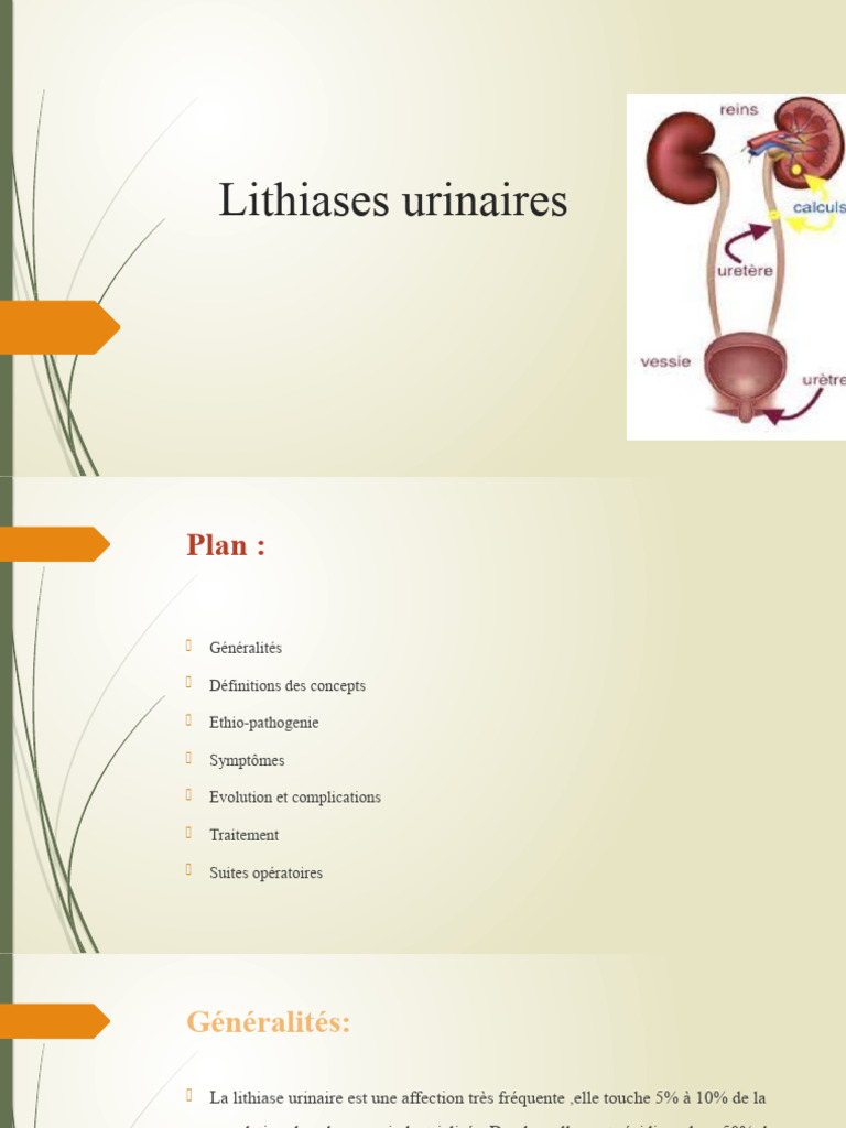 Lithiases Urinaire | PDF