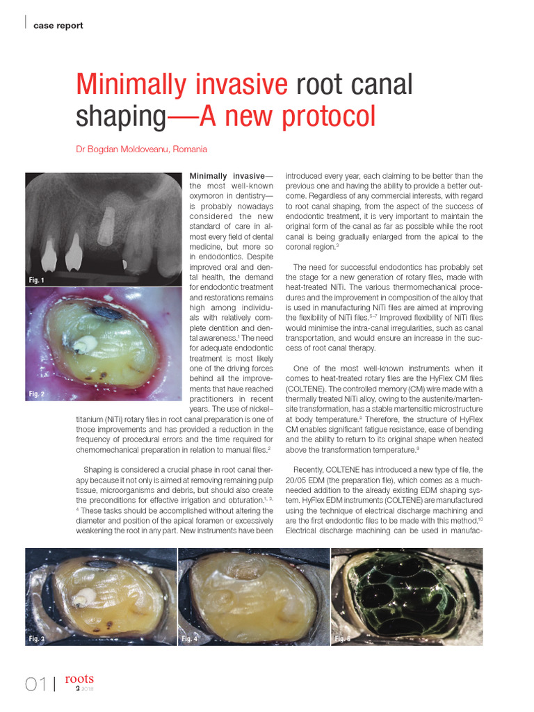 Minimally Invasive Root Canal Shaping-A New Protocol | PDF