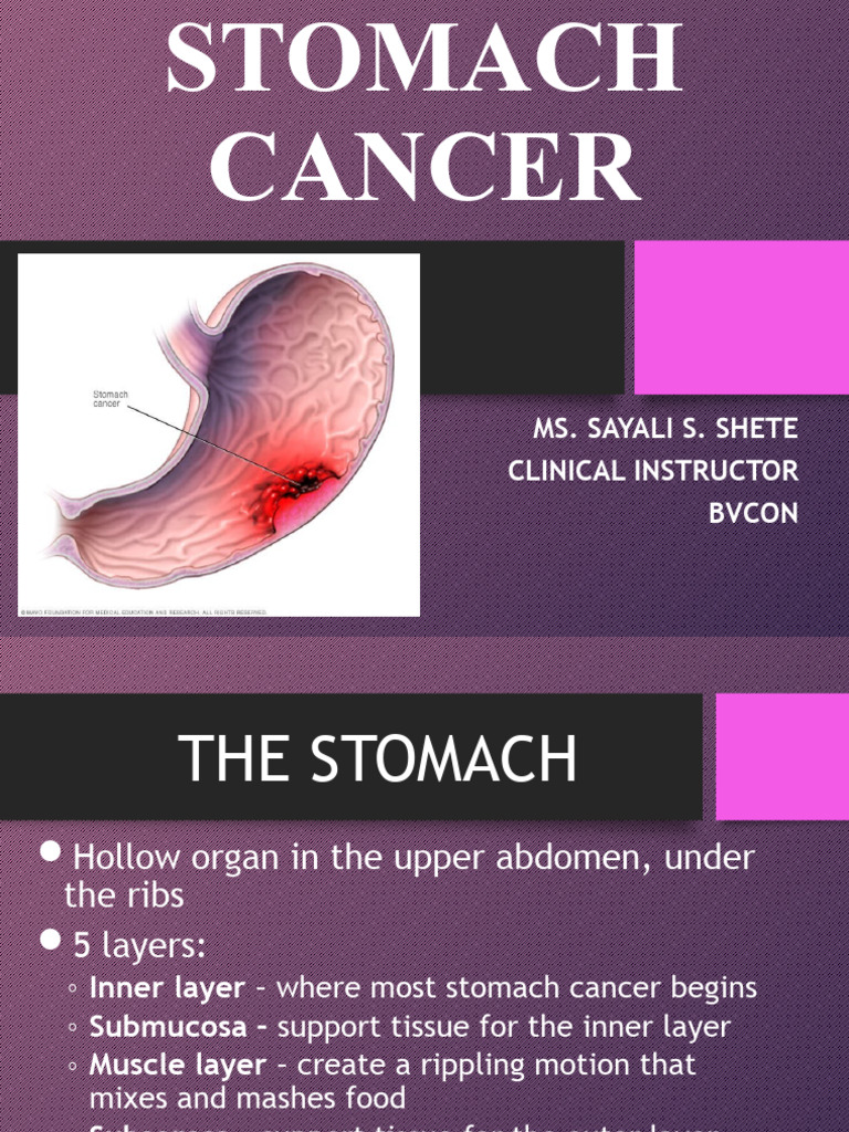 Stomach Cancer | PDF | Cancer | Biopsy