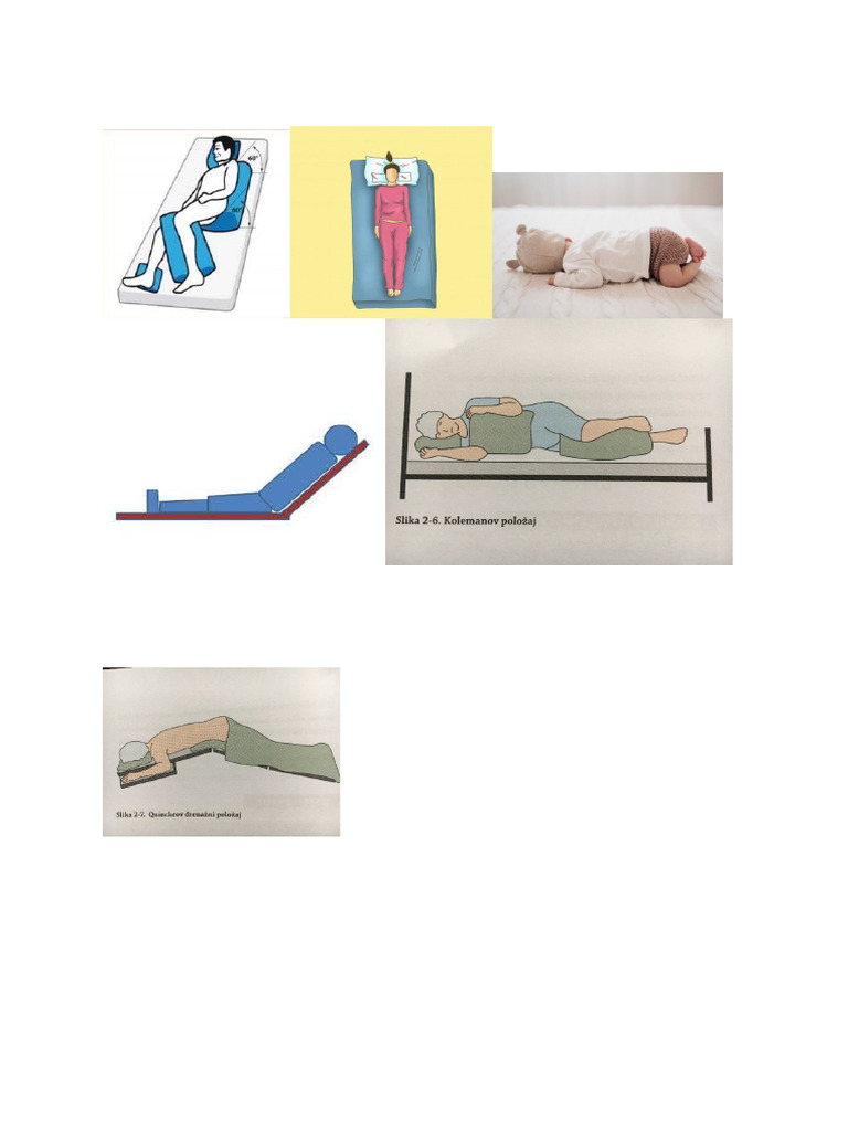 Bolesnikovi Polozaji Za Isprintat | PDF