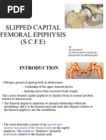 Deformities of The Spine | PDF | Vertebral Column | Scoliosis