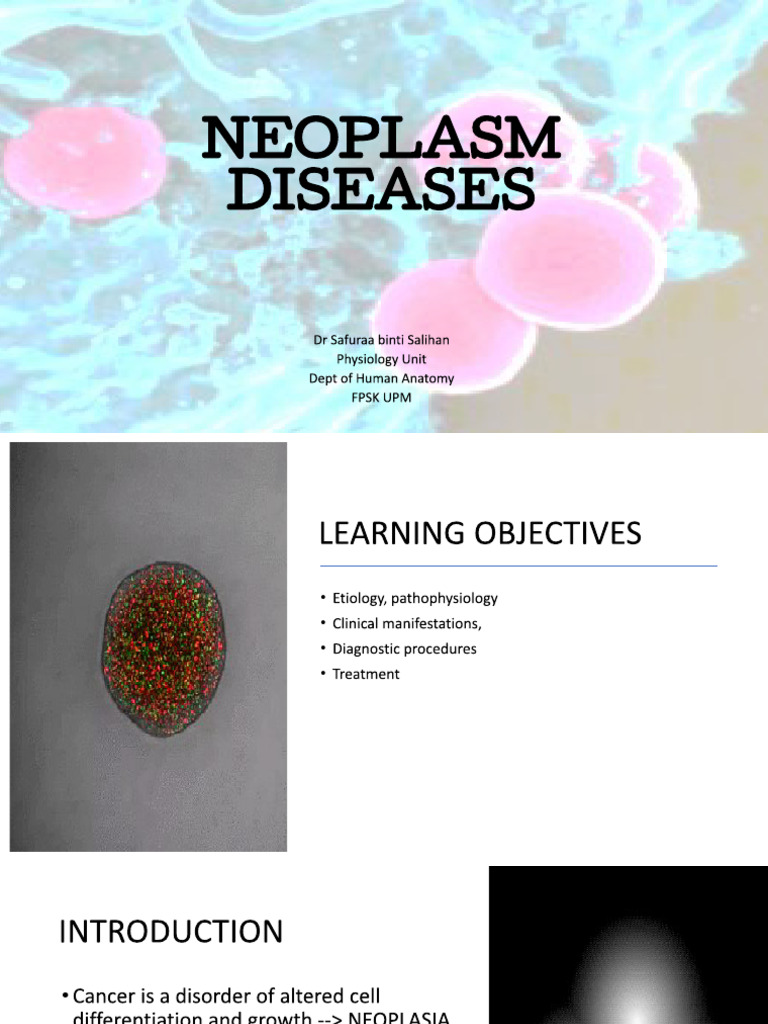 Neoplasm Diseases | PDF