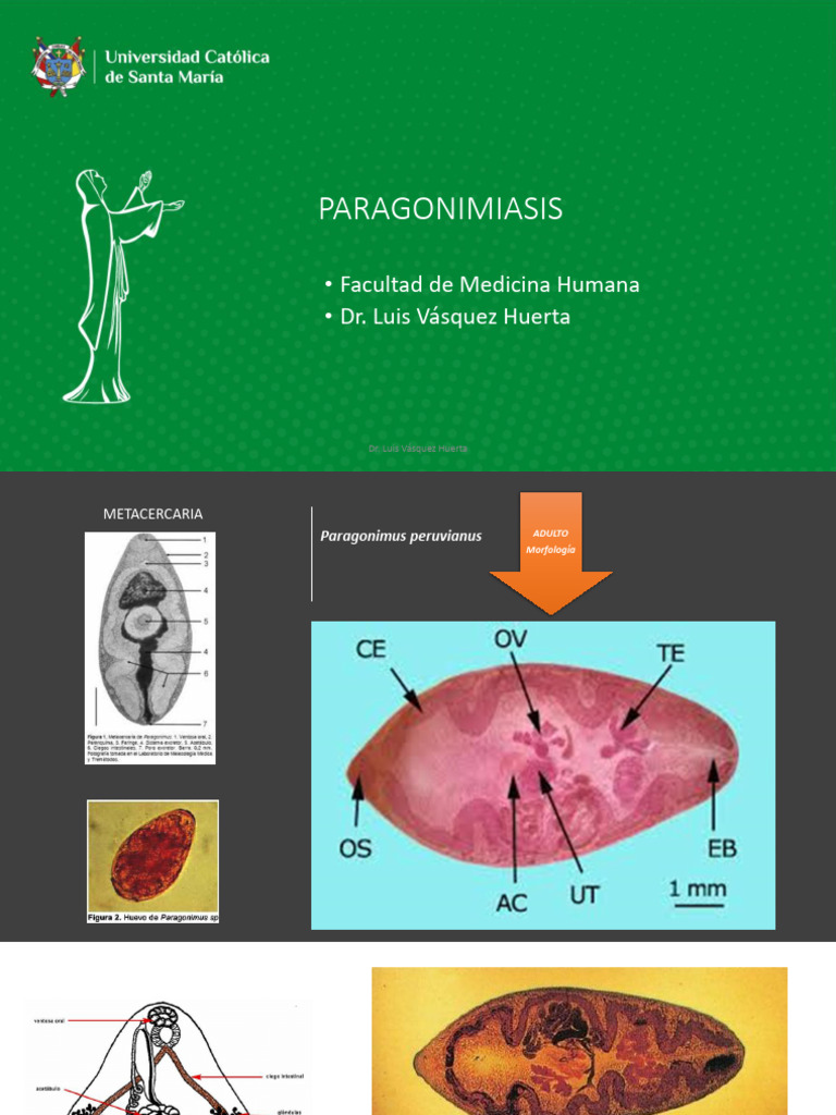 T. 13 Paragonimiasis | PDF