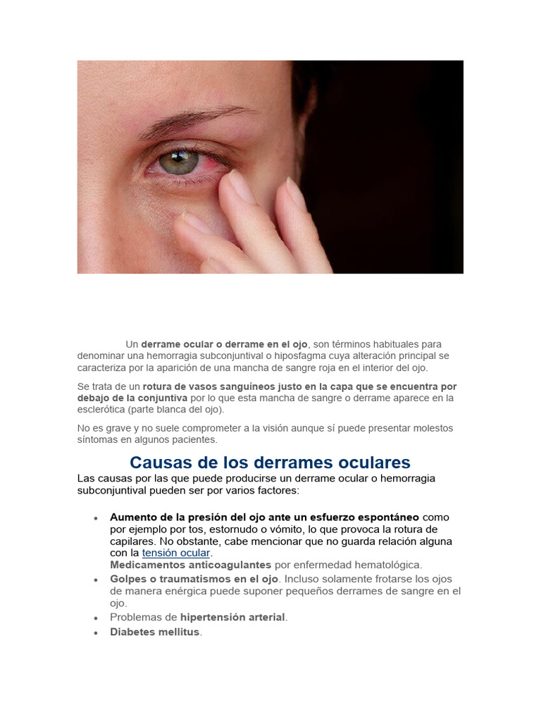 Derrame Ocular | PDF