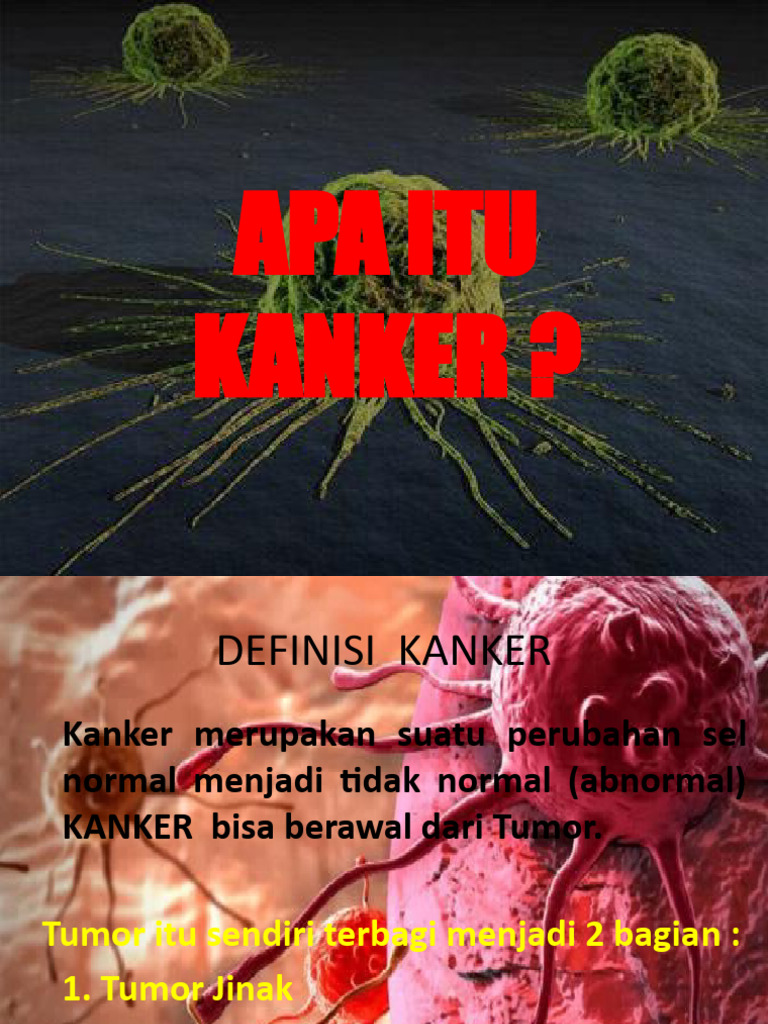 Materi Kanker | PDF