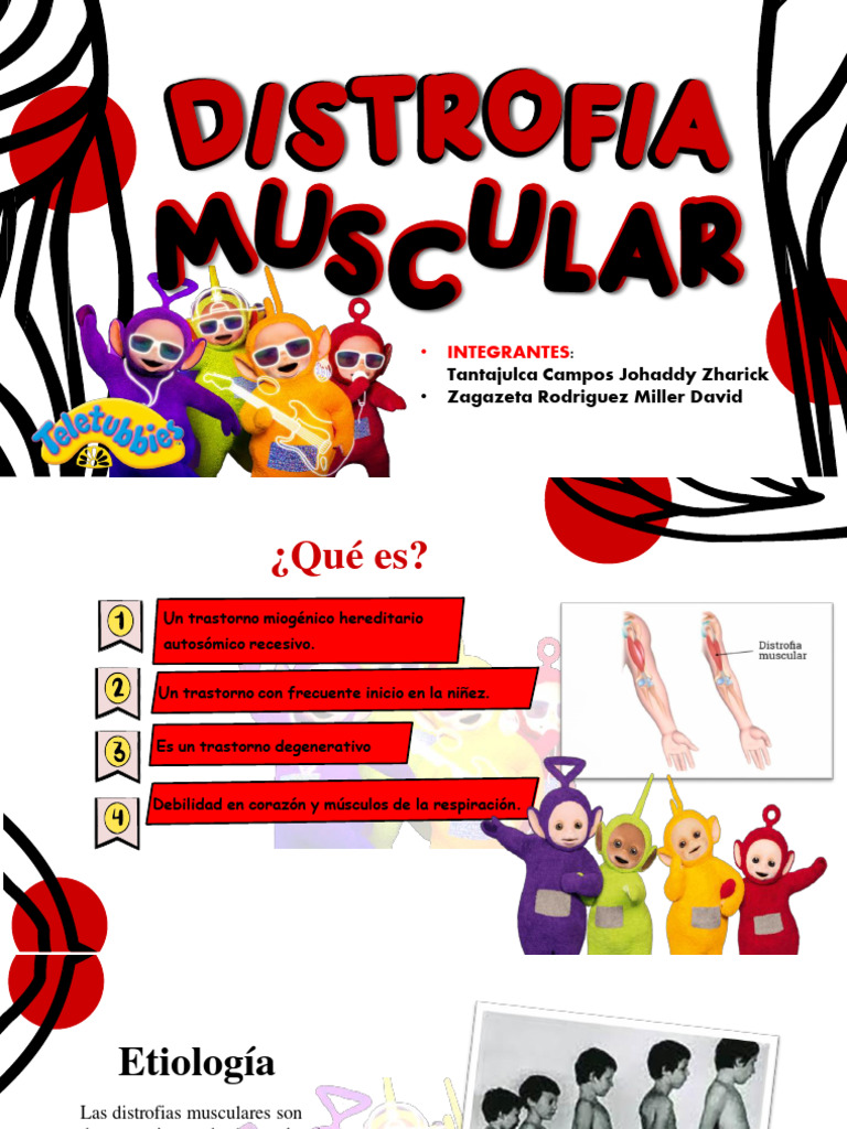 Distrofia Muscular | PDF