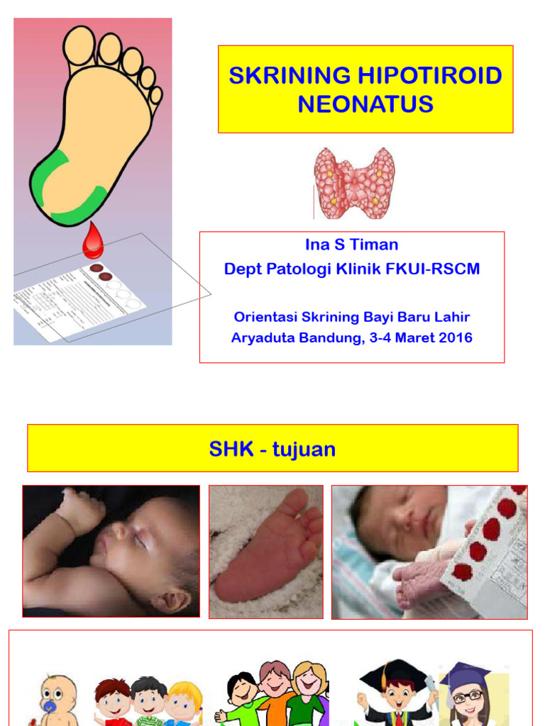 Bandung SKRINING HIPOTIROID NEONATUS 030316 | PDF