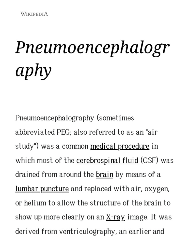 Pneumoencephalography - Wikipedia | PDF | Medical Physics | Diseases ...