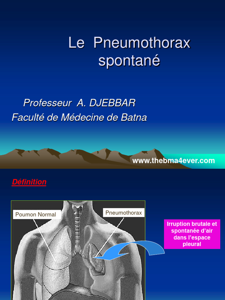 Pneumothorax Spontané : Diagnostic et Traitement | PDF | Art