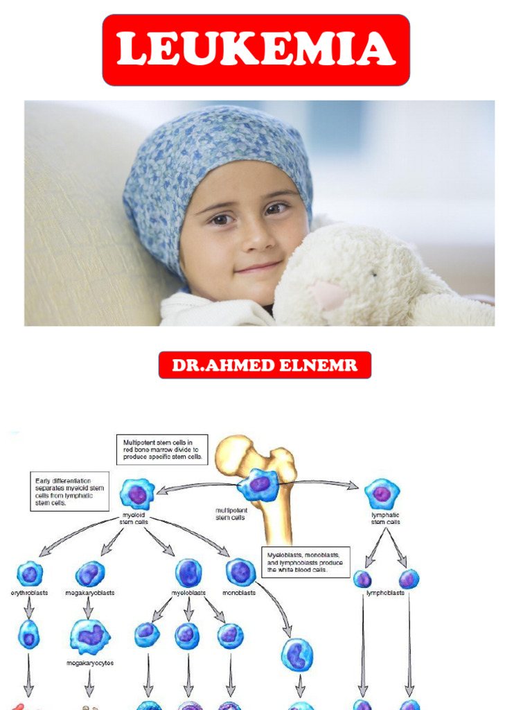 Leukemia | PDF | Leukemia | White Blood Cell