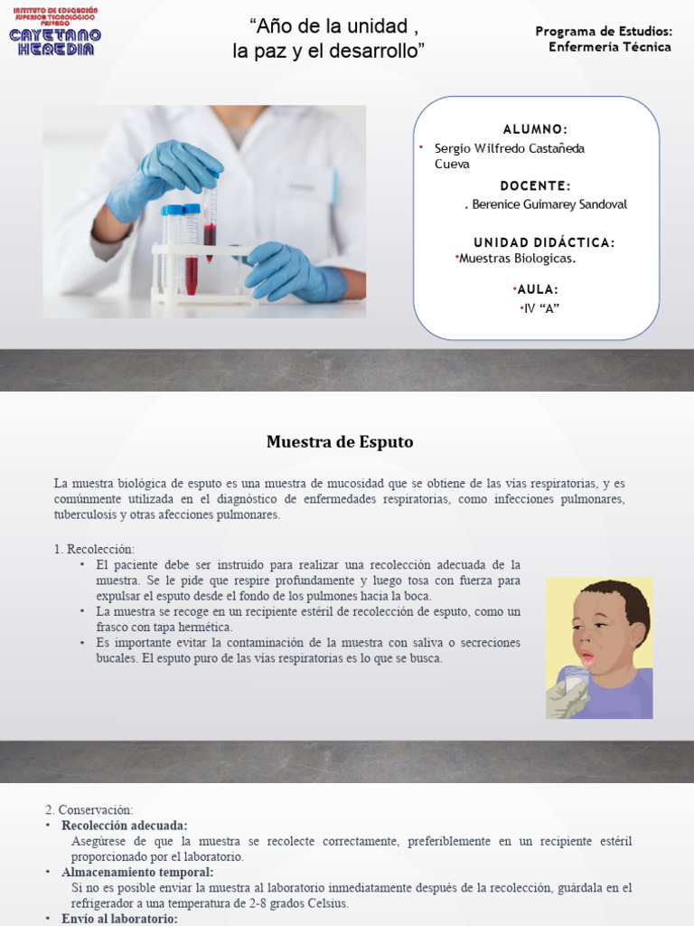 Muestra de Esputo. Sergio | PDF