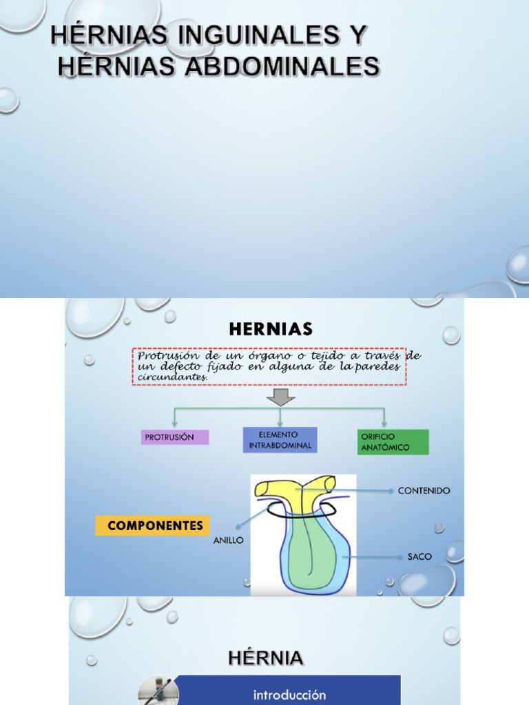 Hérnias Inguinales y Hérnias Abdominales Original | PDF