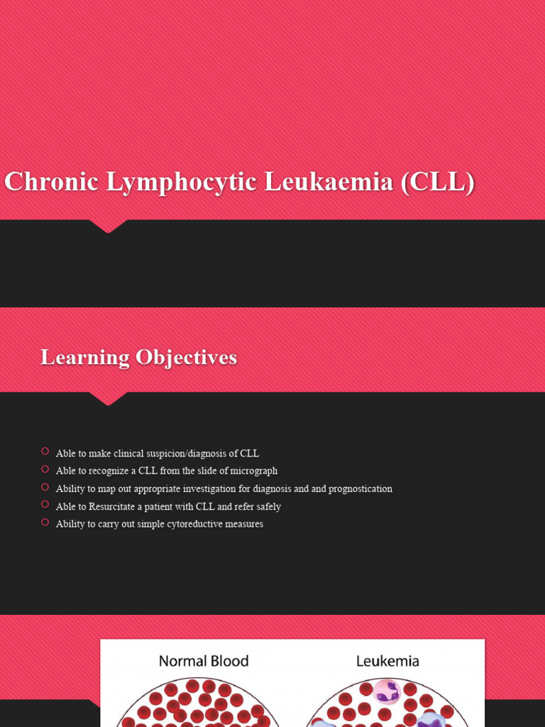 Chronic Lymphocytic Leukaemia (CLL) | PDF