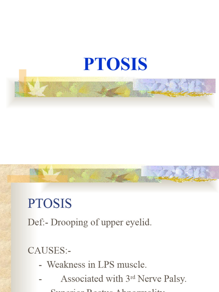 Ptosis 01 | PDF
