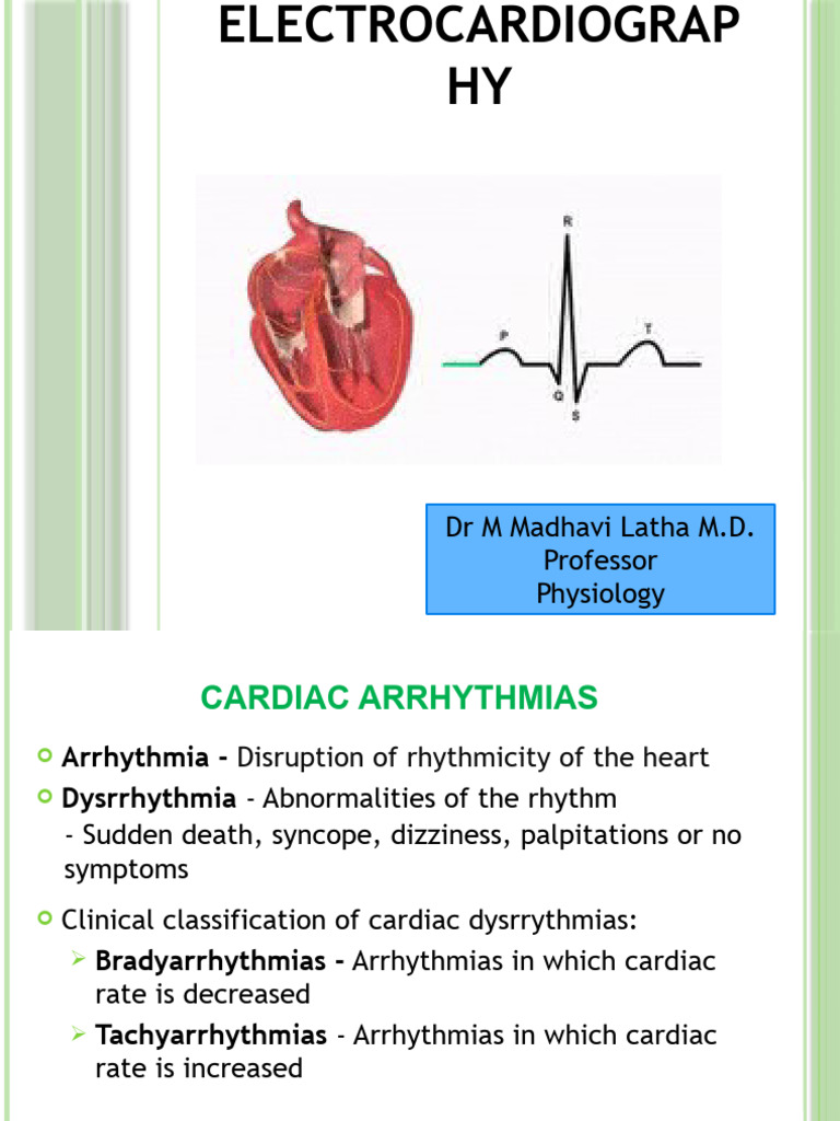 ECG-ML - Arrhythmias | PDF | Science & Mathematics