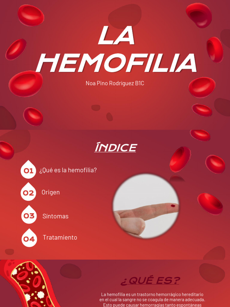 Hemofilia Noa | PDF
