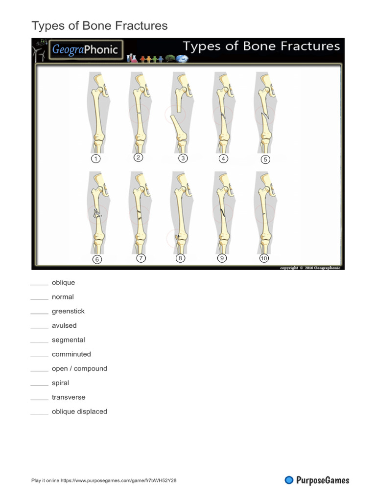 Fracture Worksheet | PDF