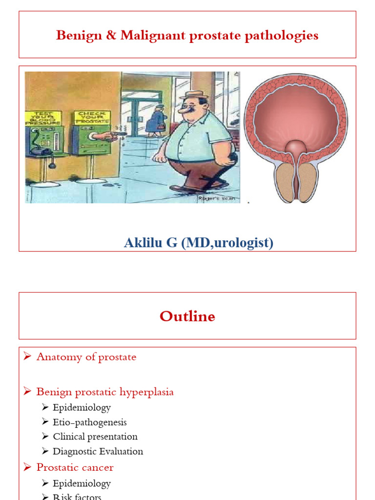 Prostate Pathologies | PDF