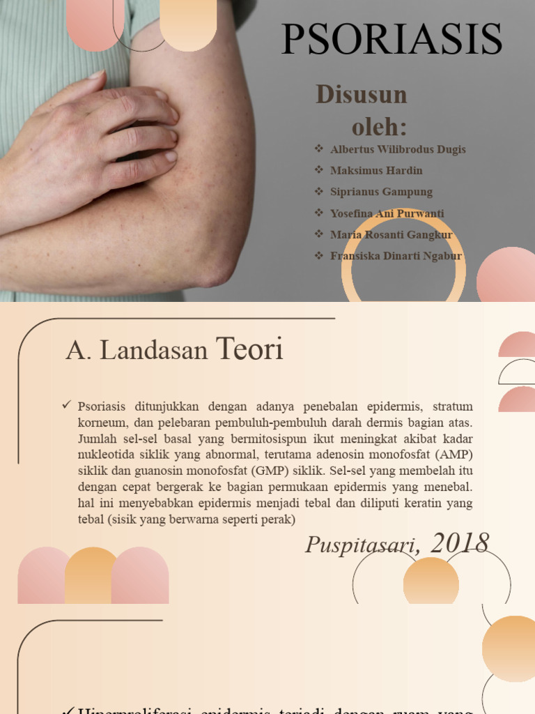 Landasan Teori PSORIASIS | PDF