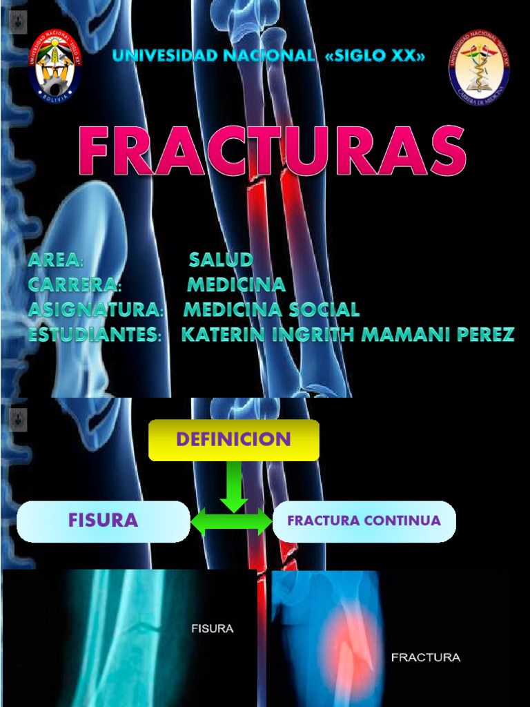 FRACTURAS | PDF