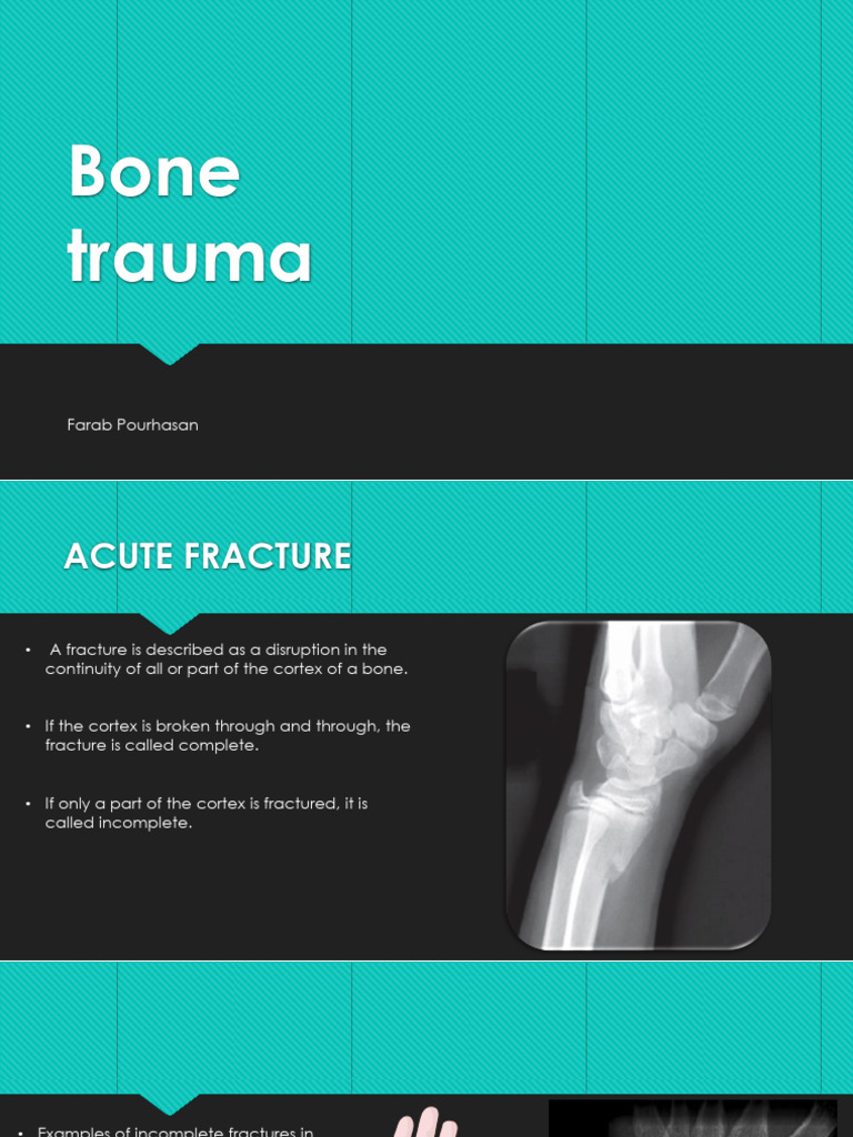 Bone Trauma | PDF