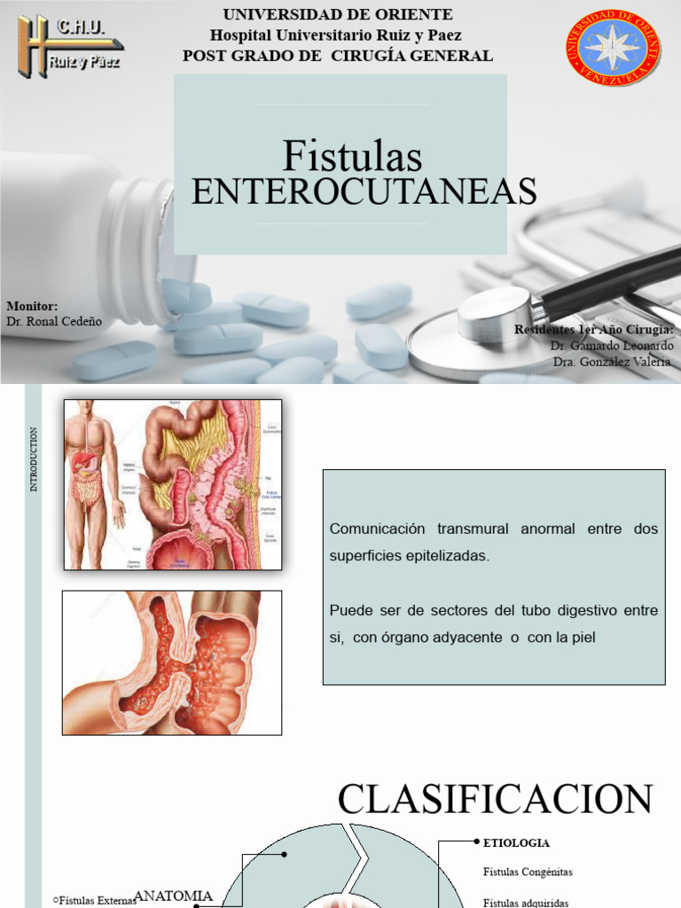 fistulas entericas | PDF | Sistema digestivo humano | Cirugía