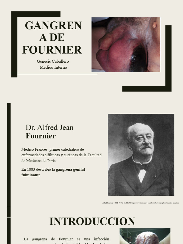 Gangrena de Fournier | PDF