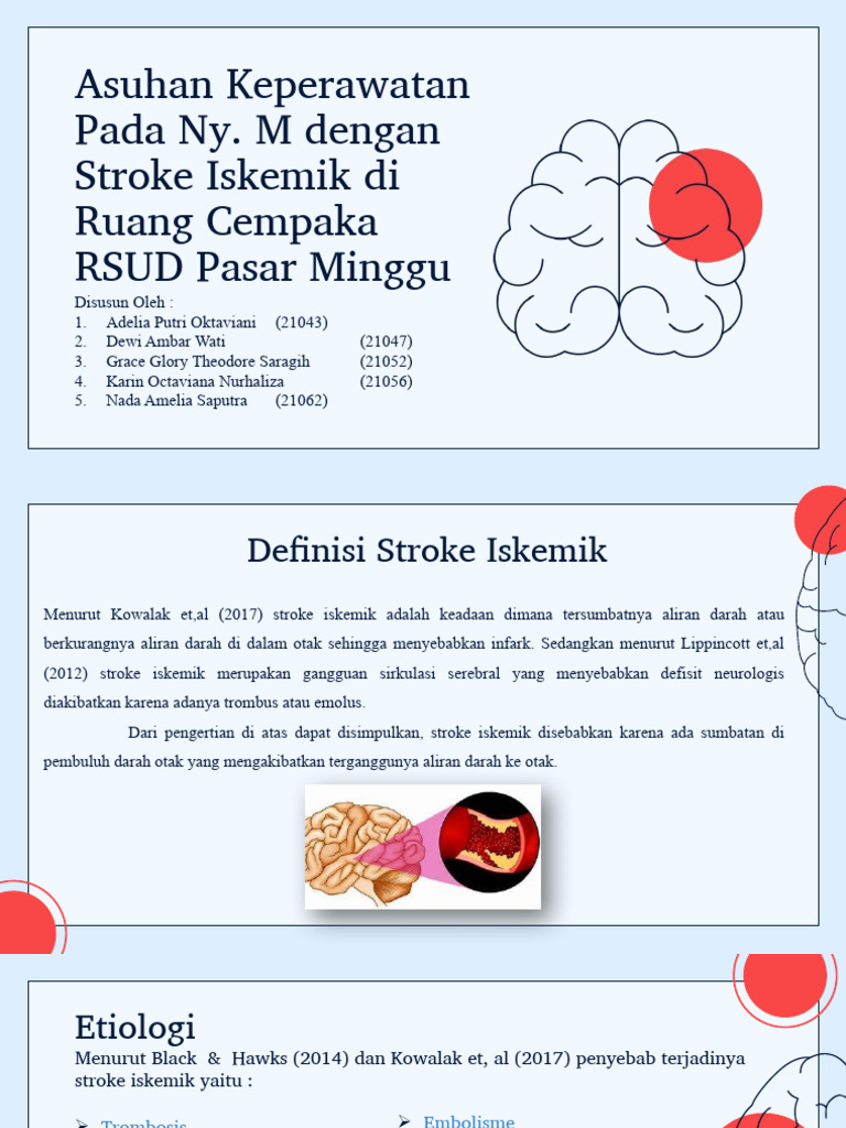 Seminar KMB II Stroke Iskemik | PDF