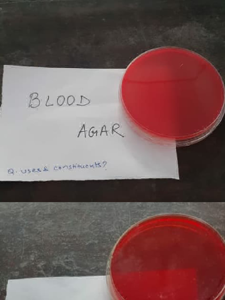 Micro Spotting-1 | PDF