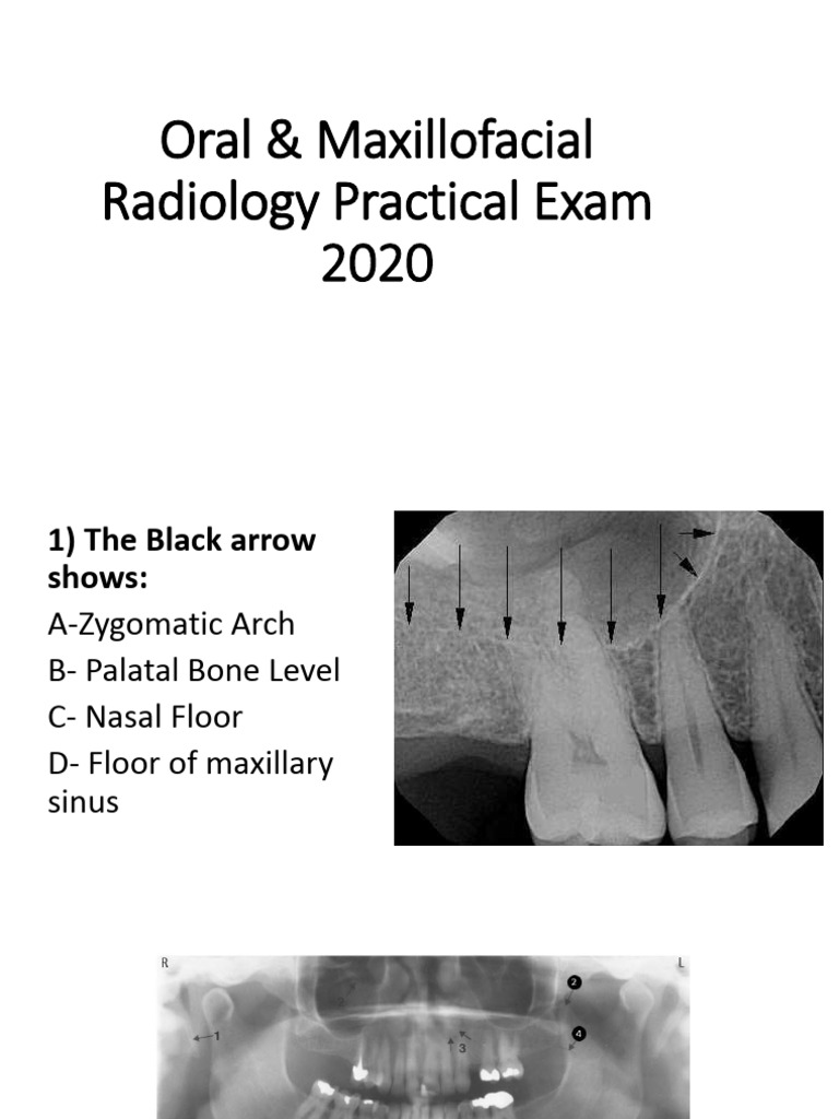 Oral Maxillofacial Radiology | PDF