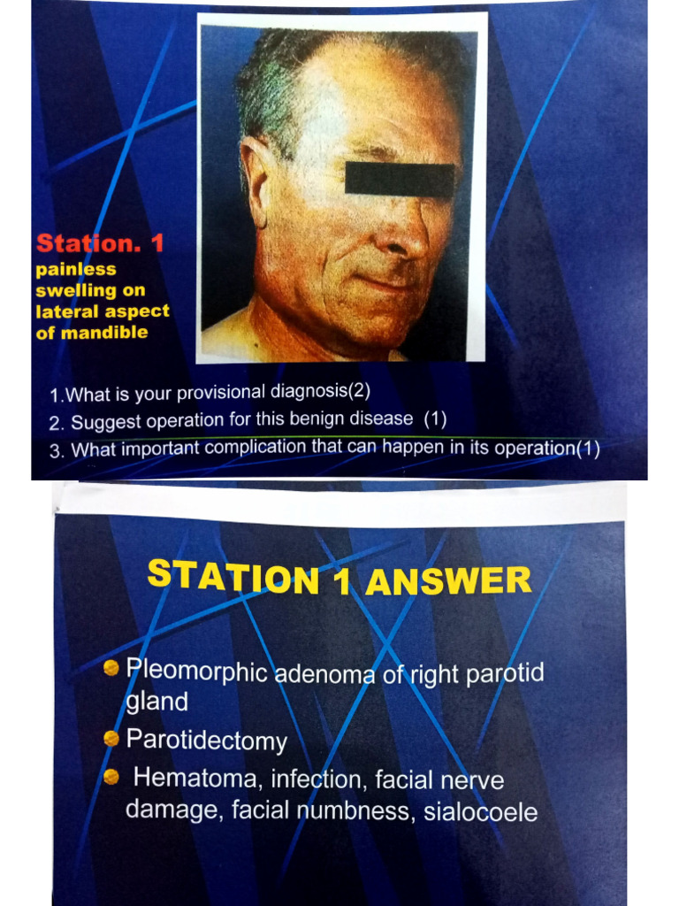 Surgery Osce Solved | PDF