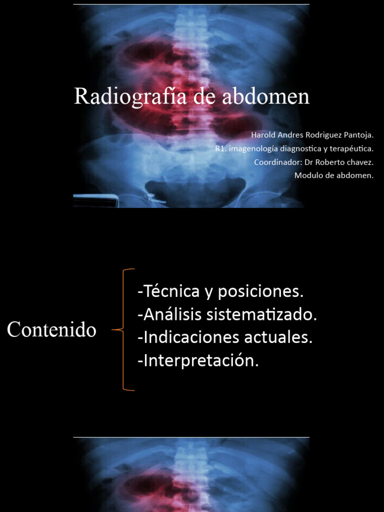 Radiografía de Abdomen | PDF | Intestino grueso | Abdomen