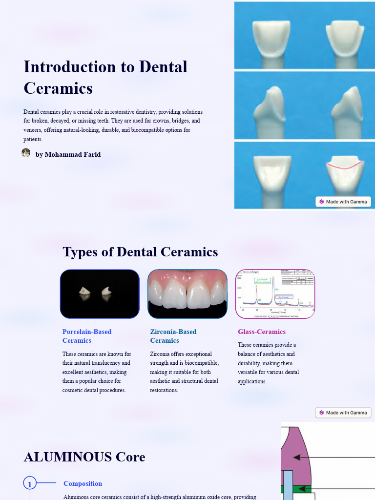 Introduction To Dental Ceramics | PDF