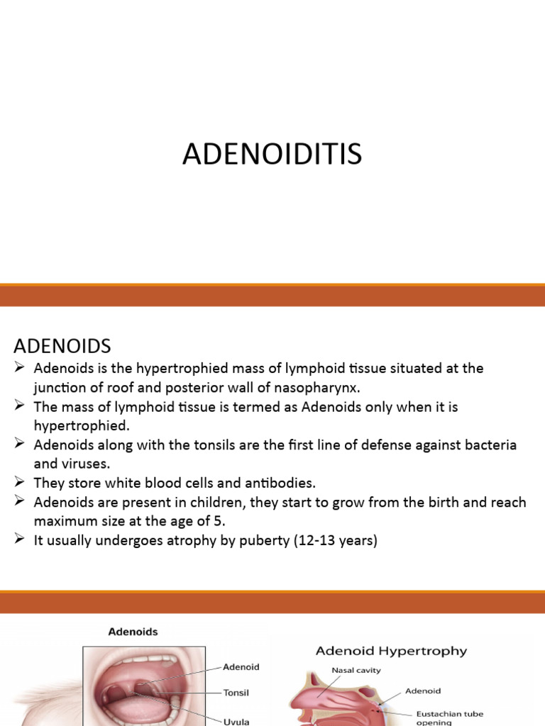 ADENOIDITIS | PDF