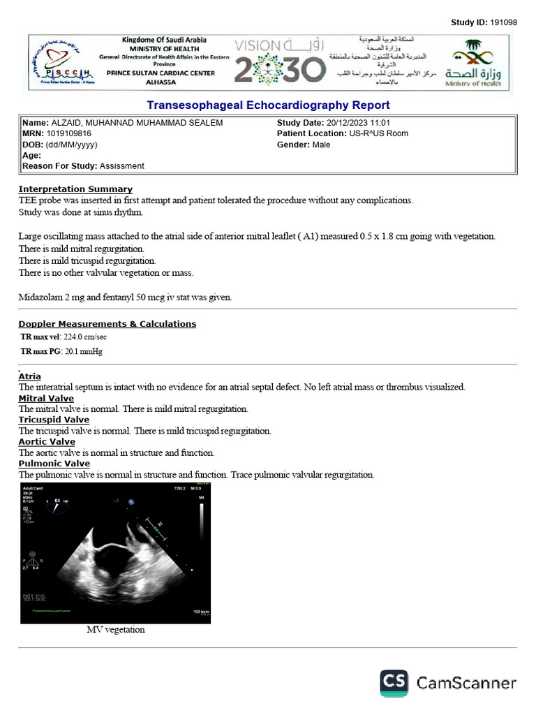 Transesophageal Echocardiography Report: 224.0 Cm/Sec 20.1 MMHG | PDF
