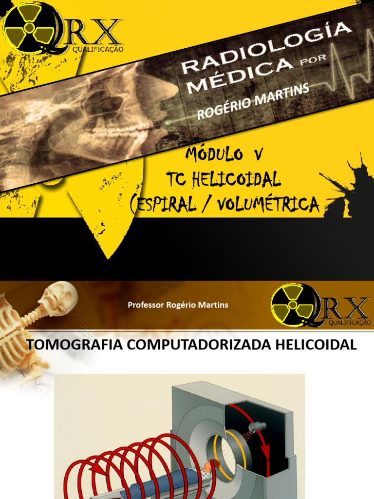 TC HELICOIDAL - Cópia | PDF