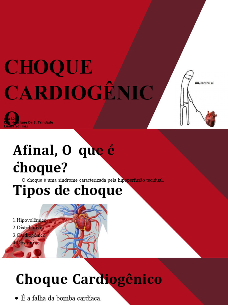 Choque Cardiogênico: Causas e Tratamento | PDF