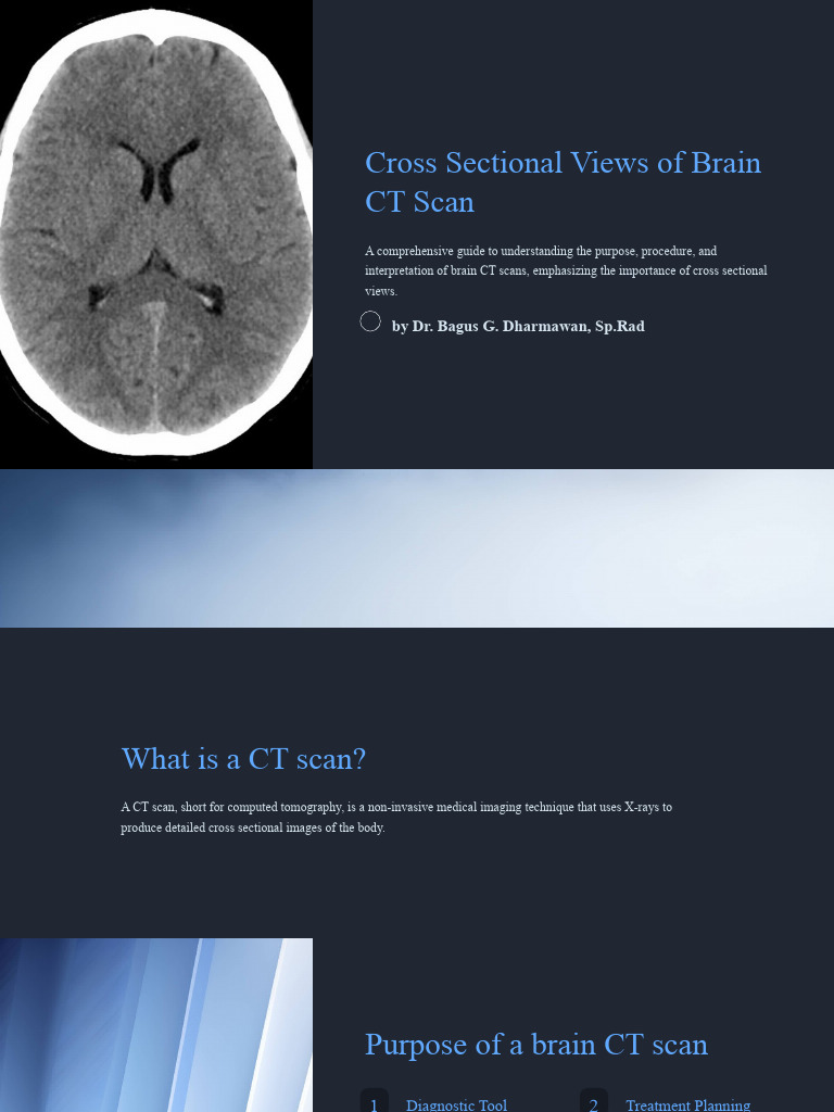 Cross Sectional Brain CT-Scan | PDF