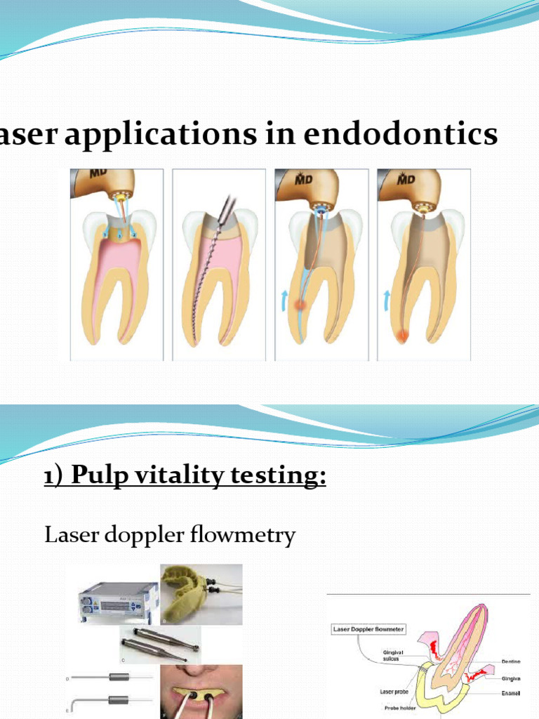 Section Laser Endo (1) | PDF