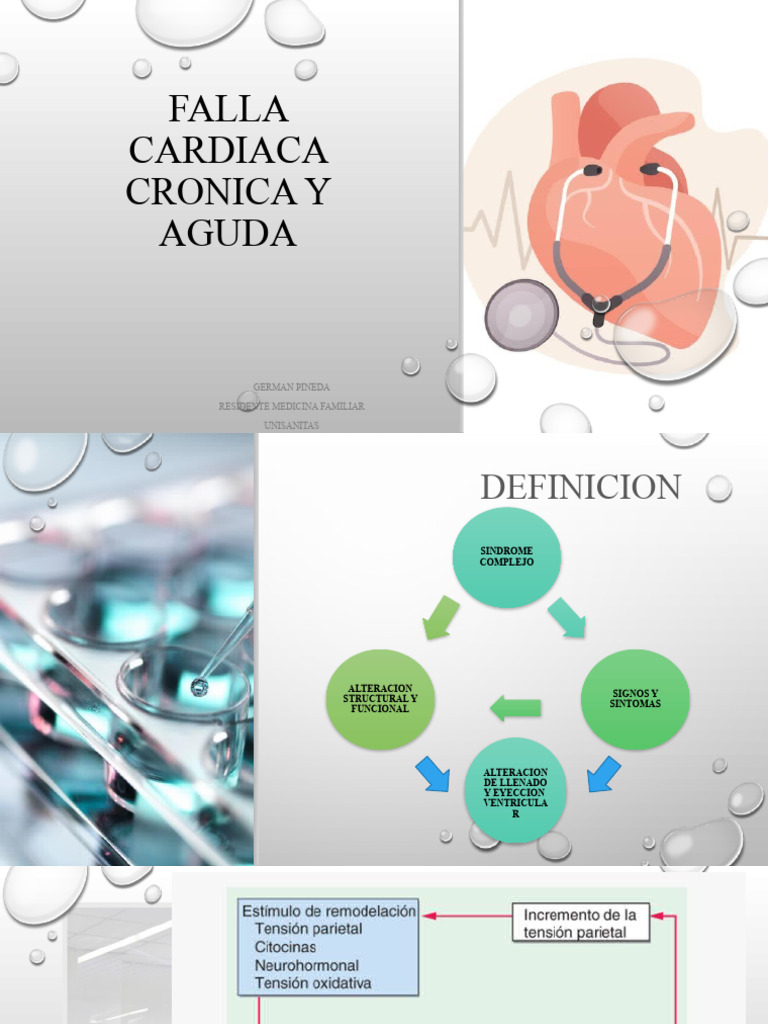 Falla Cardiaca Cronica y Aguda | PDF