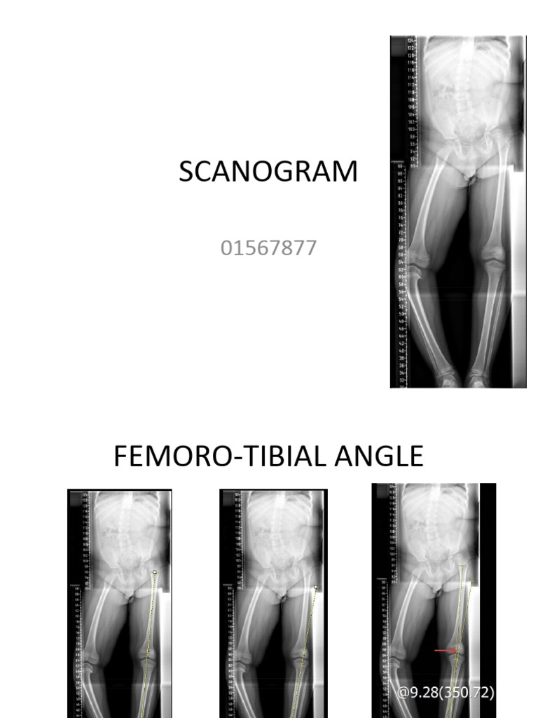 SCANOGRAM | PDF
